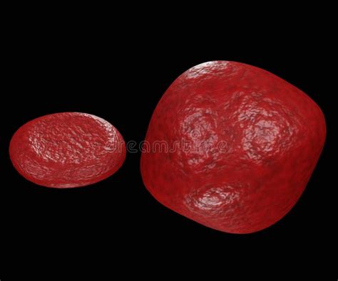 Macrocytic Anemia Stock Illustrations 8 Macrocytic Anemia Stock