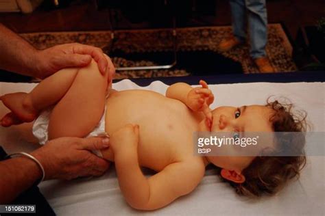 Luxation Photos And Premium High Res Pictures Getty Images