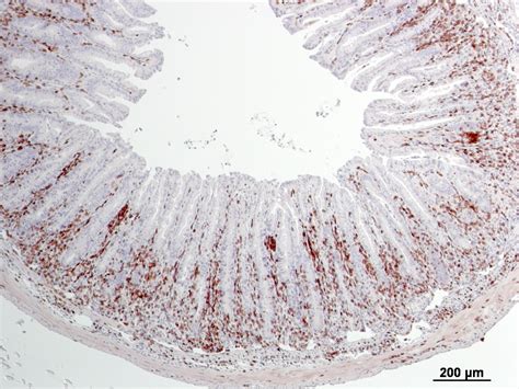 Advancing Ibd Research Epistem