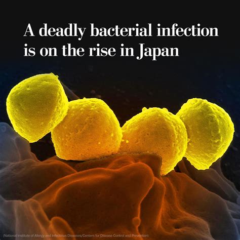 Bacterial Infection Bacterial Infection Mrsa Infection Methicillin