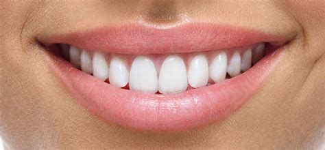 La Importancia De La Encía En Los Implantes Clínica Dental Urculo Burgaz