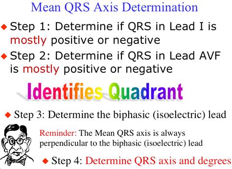 Qrs Determination