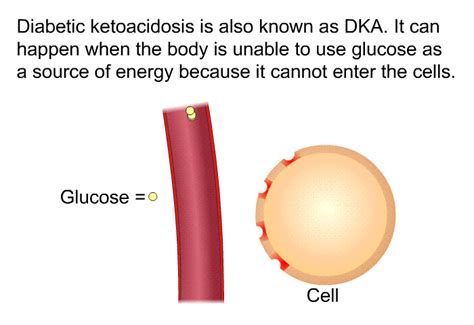 Diabetic Ketoacidosis Dka