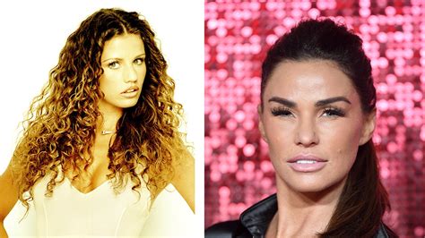 Katie Price Before And After