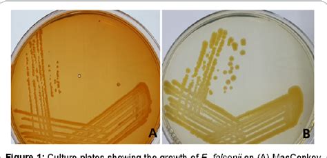 Empedobacter Sp M95 Semantic Scholar