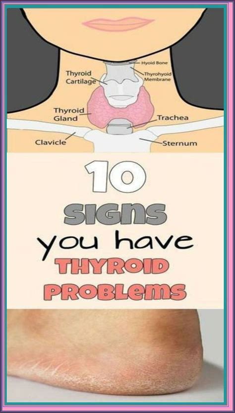 How To Test Your Thyroid Artofit
