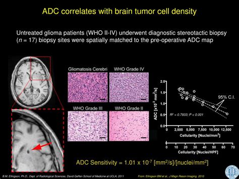 PPT Functional Diffusion Maps FDMs For Brain Tumor Treatment