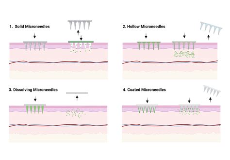 Microneedle Delivery System Biorender Science Templates