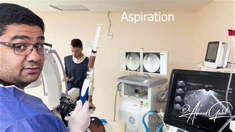 Eus Cystogastrostomy Youtube