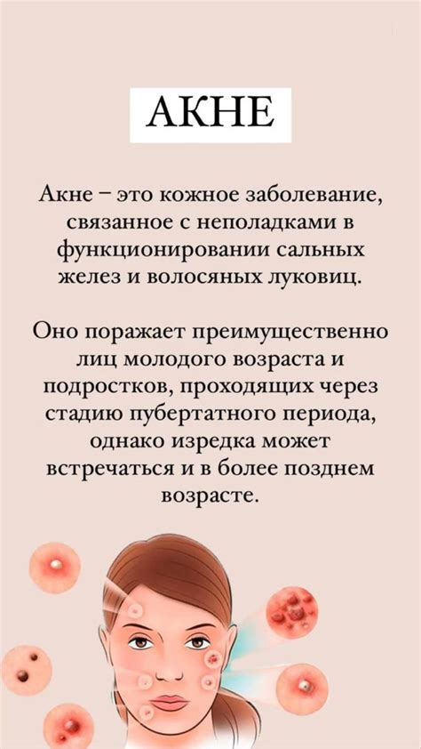 Акне прыщи уход за лицом Уход за кожей сторис косметолог лечение акне Cosmetology Wedding