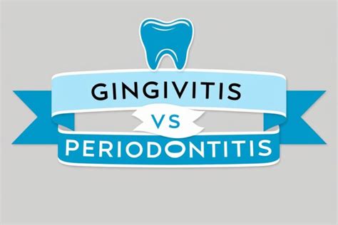 Gingivitis Vs Periodontitis Aria Dental