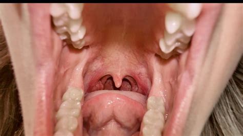 Minutes Of Uvula Views Sneeze Goddess Clips Sale