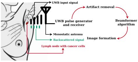 Evaluating The Performance Of Algorithms In Axillary Microwave Imaging Towards Improved Breast