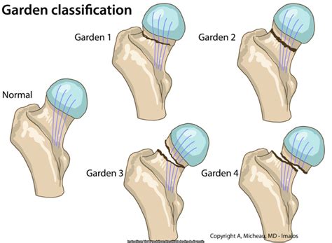 A Glossary Of Commonly Used Classifications In Medical Imaging