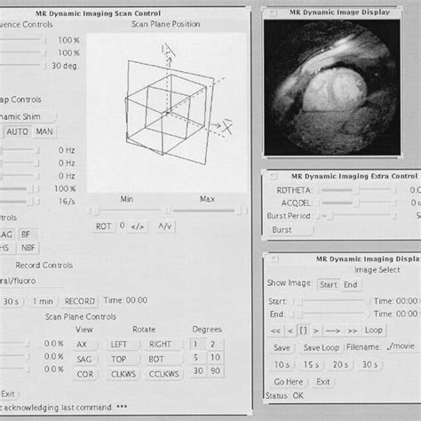 Four X Windows The Graphical User Interface Windows Are Imaging Scan