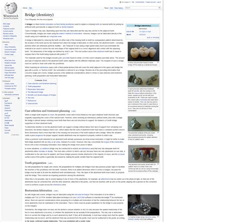 📕 瑞德美牙醫 知識專欄文章 ♦ 「假牙」這個詞跟「牙冠」的區別：什麼是「牙齒補綴」與「贗復牙科」？「贗」這個字怎麼念？