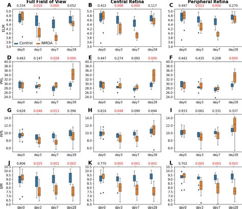 Early Inner Plexiform Layer Thinning And Retinal Nerve Fiber Layer Thickening In Excitotoxic