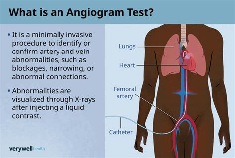 Angiogram Test Purpose And Procedure