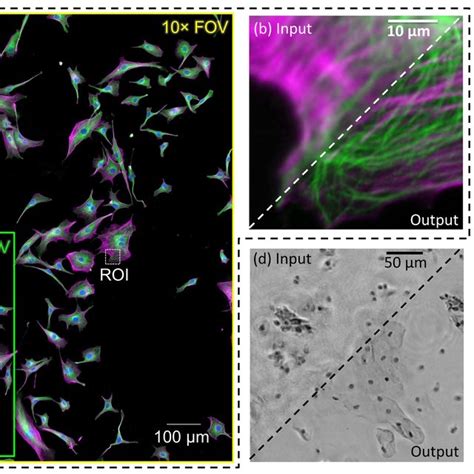 Super Resolution And Image Quality Enhancement Using Deep Learning A Download Scientific