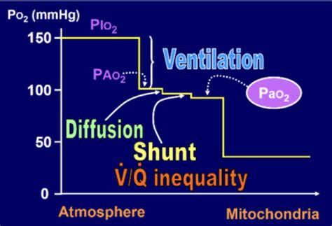 Ventilation Perfusion Relationships And Causes Of Hypoxemia Flashcards