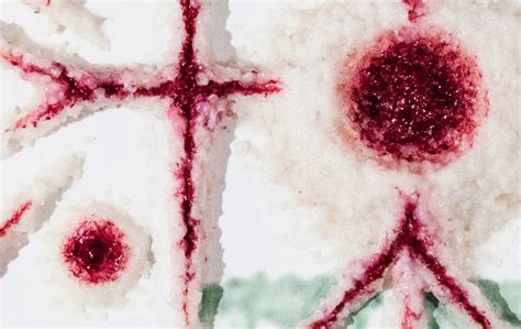 Wound Pattern — Yuqi Wang