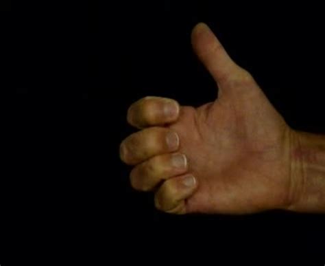 Metacarpophalangeal Joint Extension