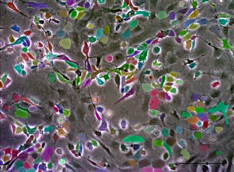 Cellpose Gui Accuracy Metric Concern Image Analysis Image Sc Forum