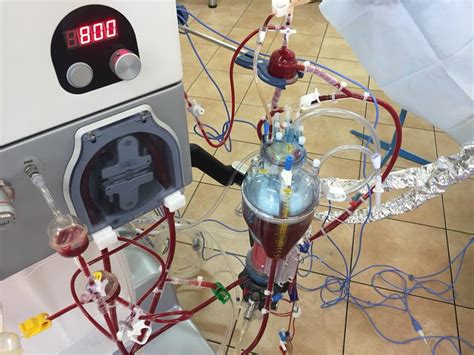 Odesa National Medical University Сonducting Another Isolated Limb