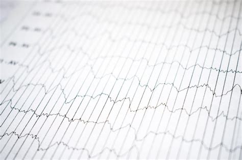 Premium Photo Eeg Electrophysiological Monitoring Method Eeg Wave In Human Brain Brain Wave