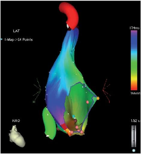 Electroanatomical Map Of Right Atrium Showing The Counterclockwise Download Scientific Diagram