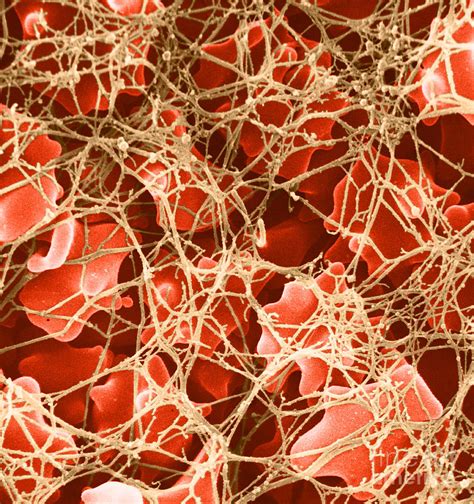 Blood Clot Sem Of Photograph By David M Phillips Pixels