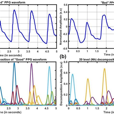 Decomposition Of A 5 Seconds Ppg Signal Segment Into Pulseshaped Download Scientific Diagram