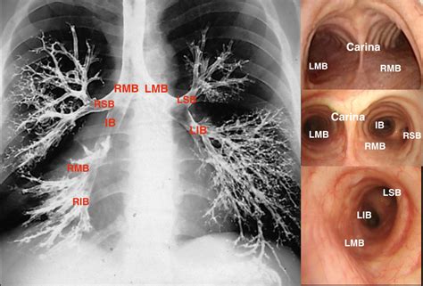 Pulmonary Physiology Clinical Tree