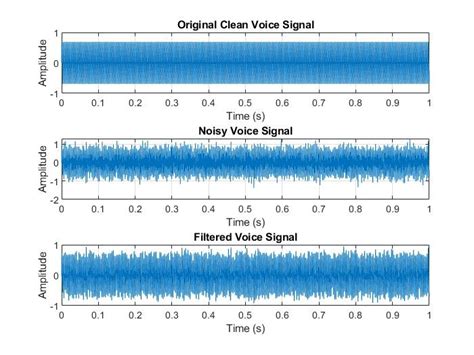 Matlab Signalprocessing Voicesignal Dsp Githubpoject Safa Bazrafshan