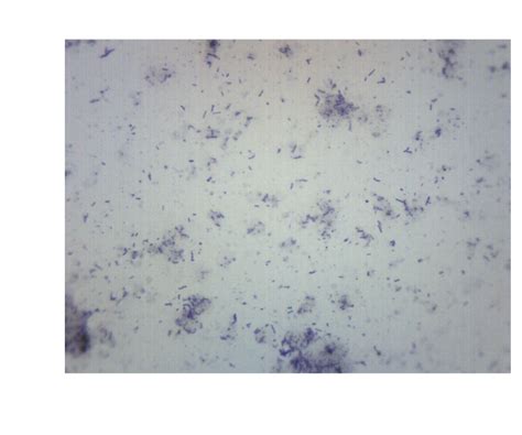 Bacteria In Mouth Under Microscope