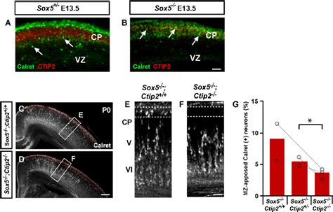 Loss Of Ctip2 Function Partially Rescues The Preplate Splitting Defect Download Scientific