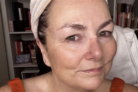 Heres What Happened When I Posted My Unfiltered Skin