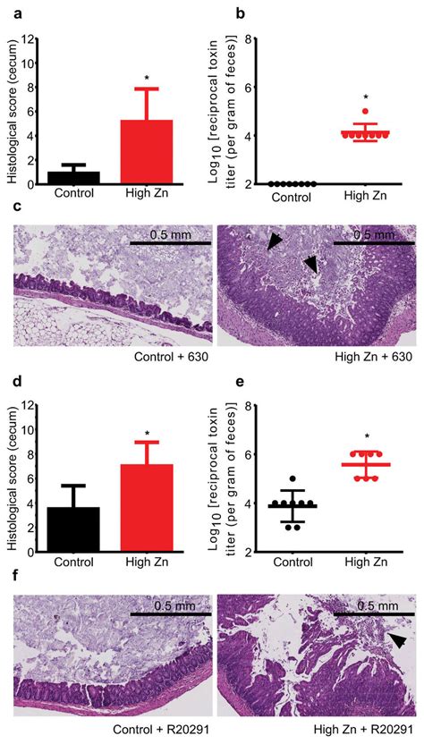 Excess Dietary Zn Exacerbates C Difficile Associated Disease