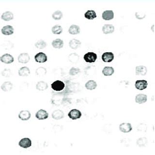 Dot Blot Of Known Sex Determining Genes Hybridized With Male Enriched Download Scientific