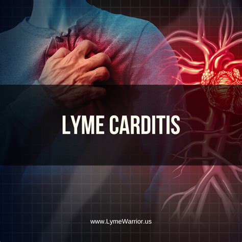 Lyme Carditis Lyme Warrior