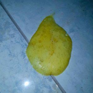 What Does Bright Yellow Dog Vomit Mean