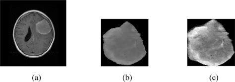 Lloyd Max Quantization A Original Mri B Extracted Roi And C