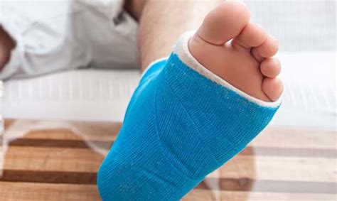 Foot Sprain Causes Treatment ALGCURE