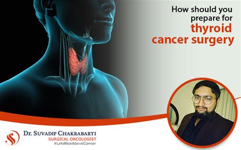 How Should You Prepare For Thyroid Cancer Surgery