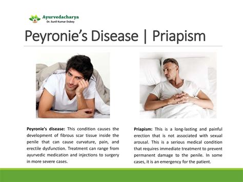 Common Male Sexual Problems Best Sexologist In Patna Bihar Dr