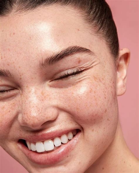 Types Of Bumps And Blemishes You Should Never Try To Pop Skin