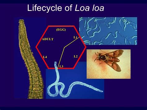 What Are The Symptoms Of Loa Loa At Larissa Morning Blog