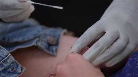 Man Gets STI Test ThisVid