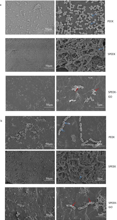 Sem Image Of Bacterial Biofilm On The Surface Of Specimens A Sem Image Download Scientific