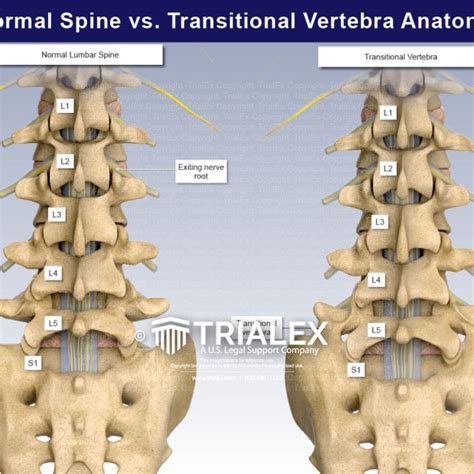 Medical Legal Exhibits Legal Animations And Trial Graphics